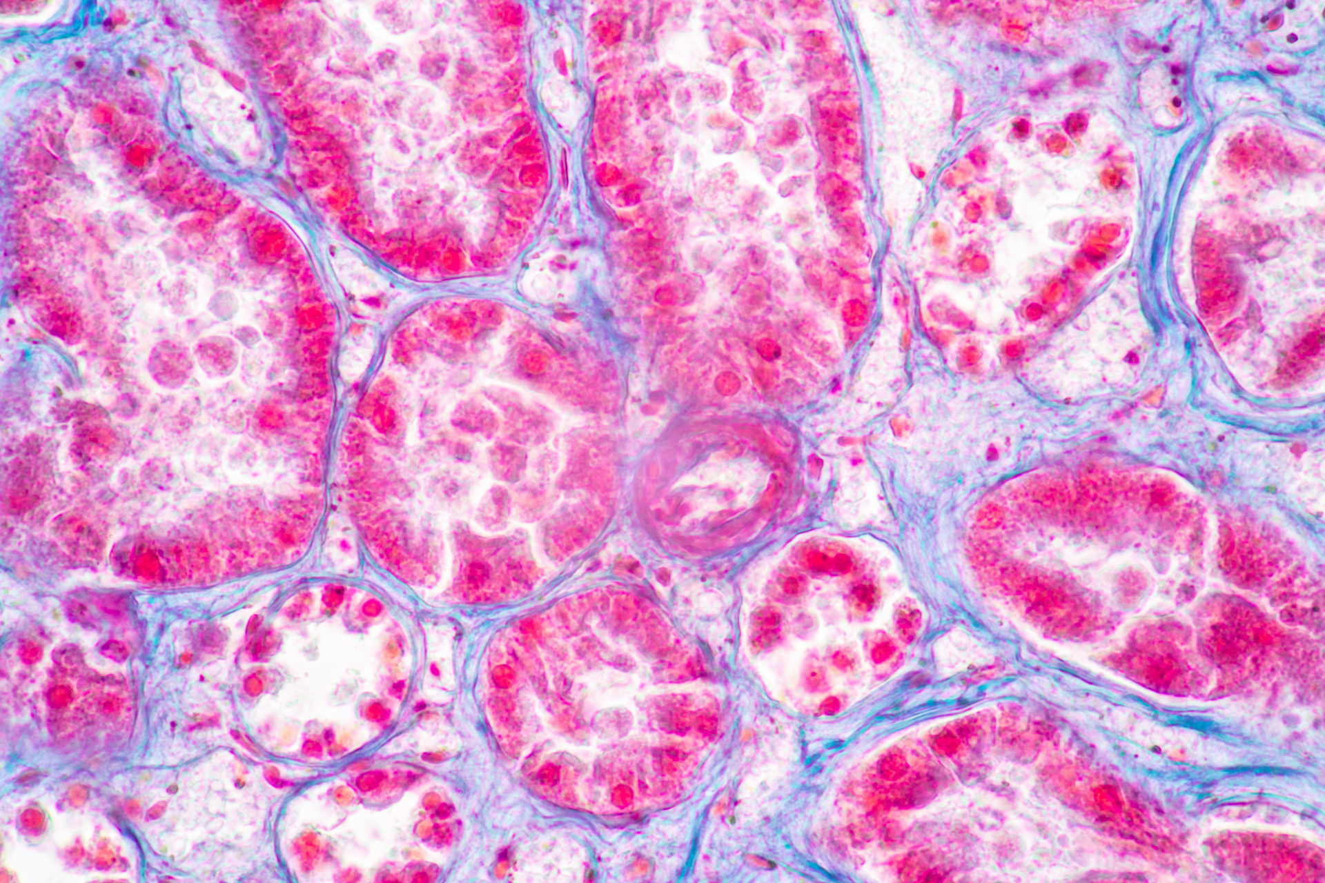2D vs 3D Cell Culture: Choosing the Right Model - by Tempo Bioscience